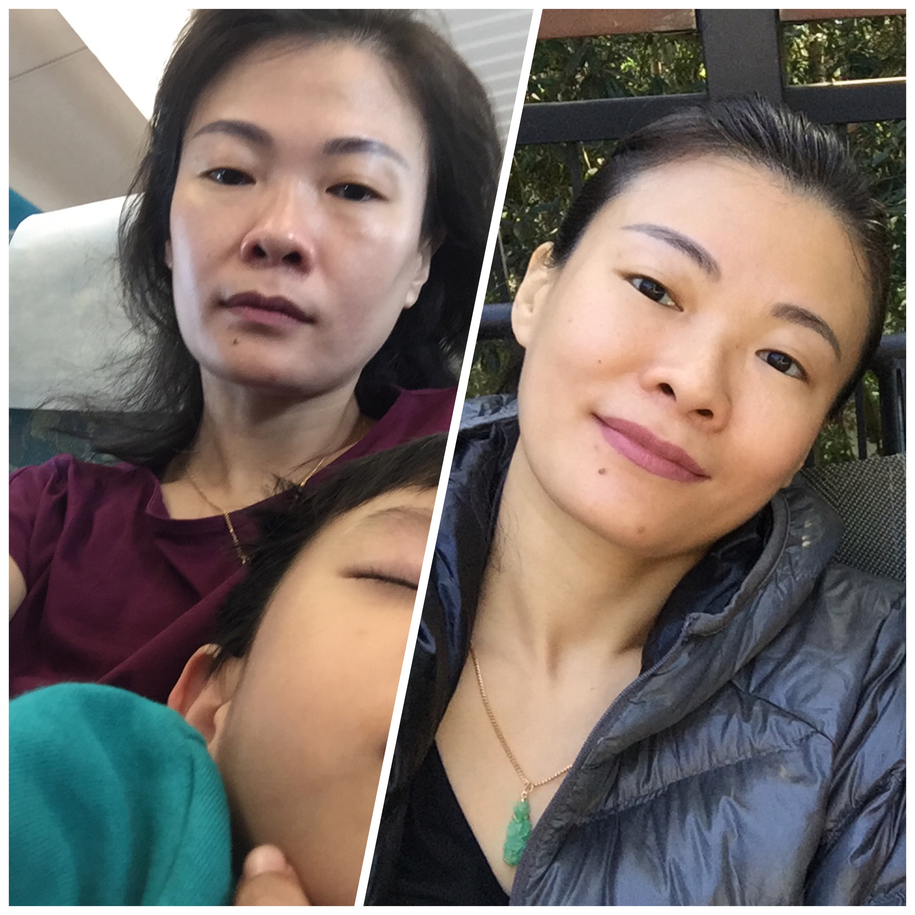 Tru Face Essence Ultra Before and After | CORRA LIEW